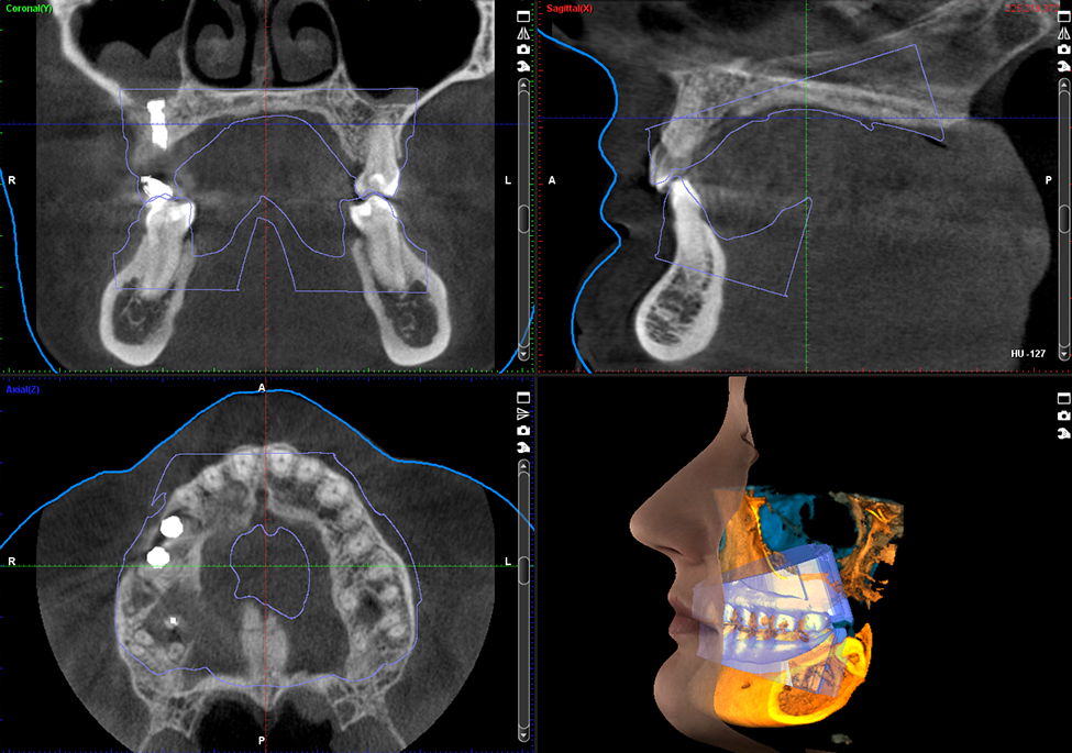 Centros C3D Odontología Digital: Planificación 3D, CBCT, Escáner Intraoral y Cursos de ...